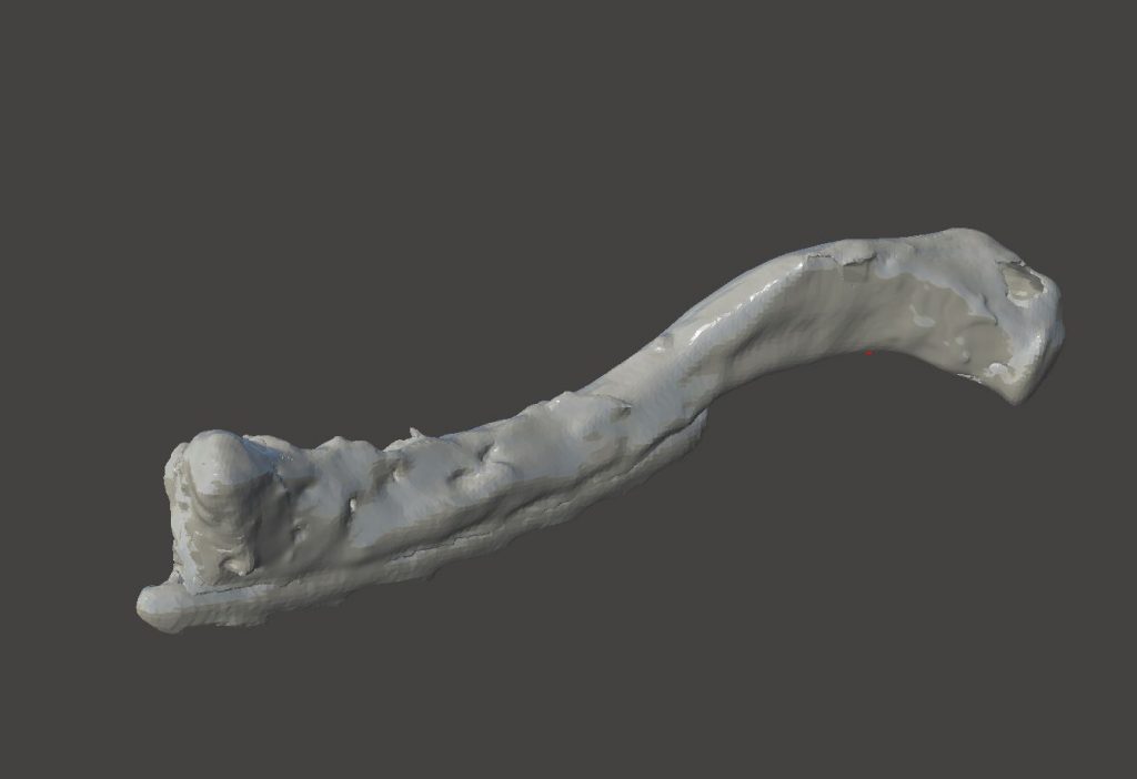 DICOM-CT-Scan-clavicle-13 - Medimodel