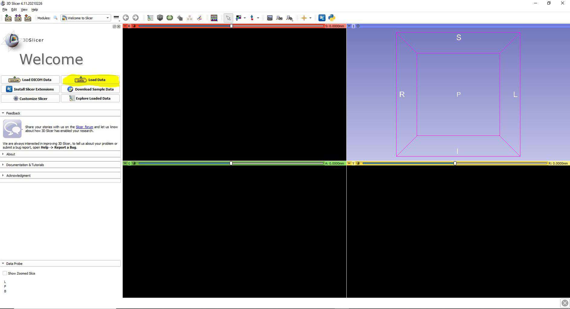 nrrd-to-dicom-for-3d-printing-slicer-1 - Medimodel